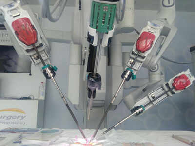 Robots better than humans at helping with gut surgeries: Study - Times ...