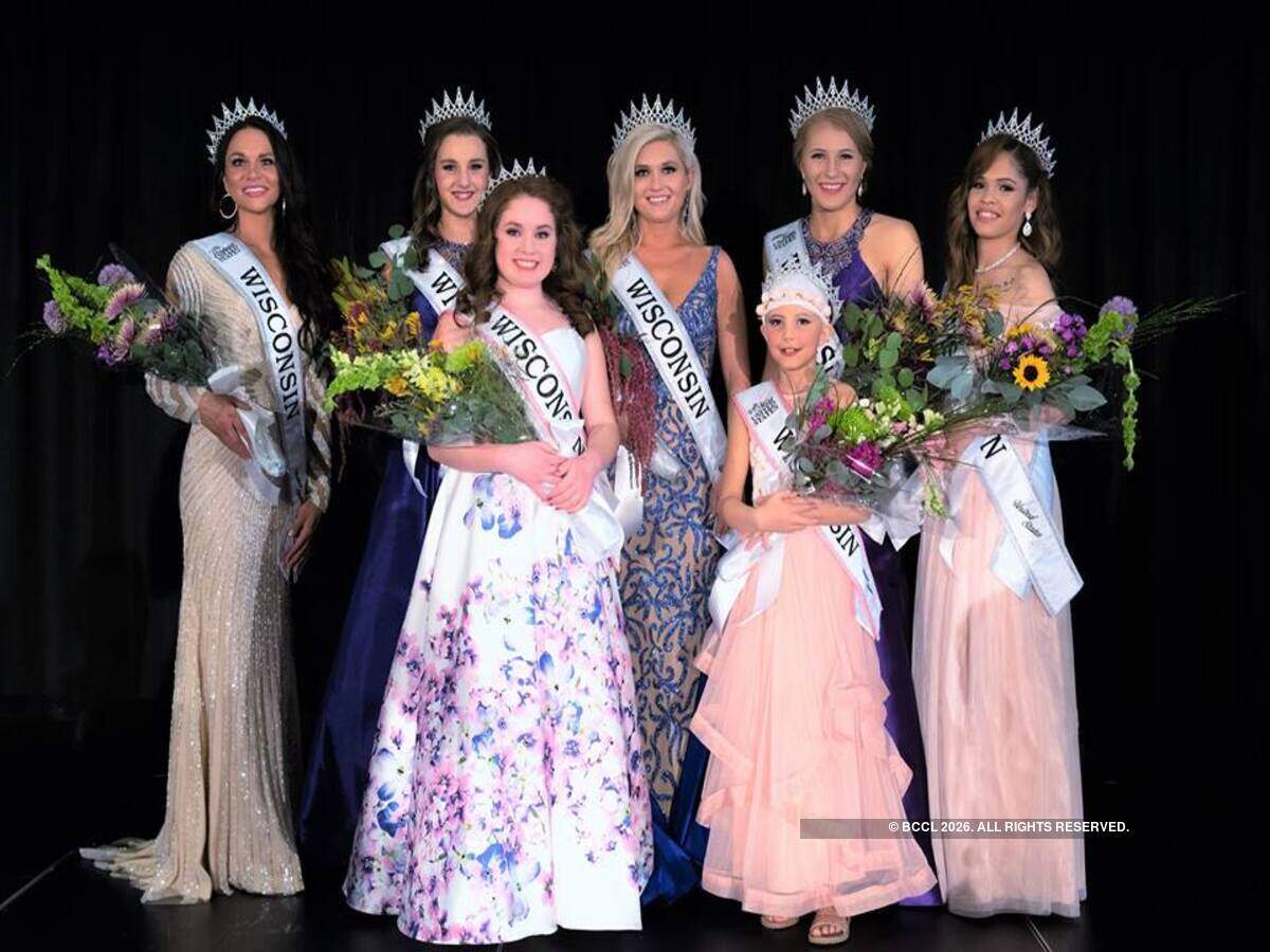 Beauty queen suffering from hair loss wins pageant