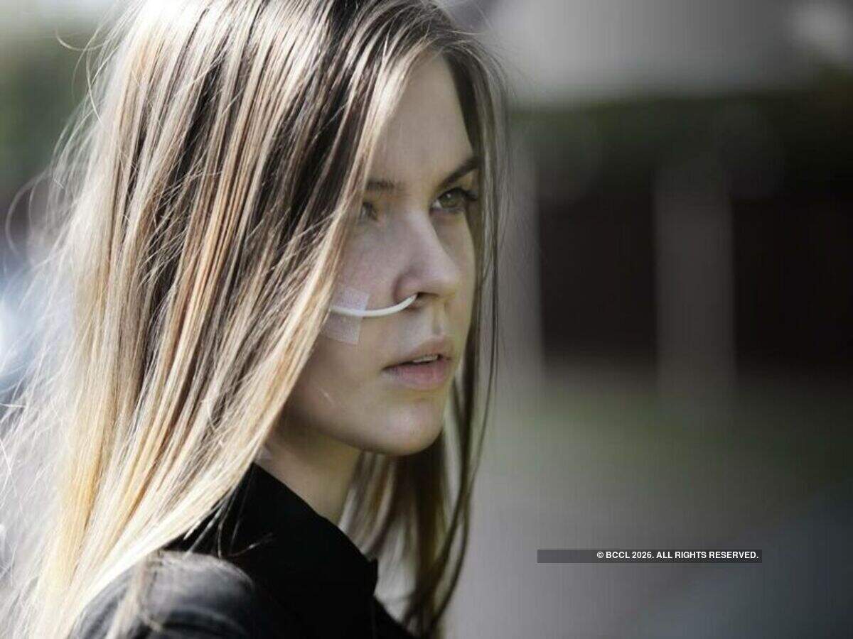 Beauty queen with a rare genetic disorder wins pageant