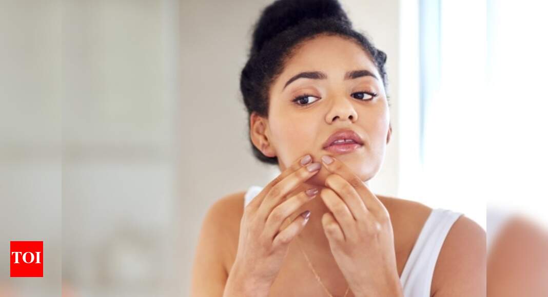 Home Remedies To Treat Pimples - Times of India