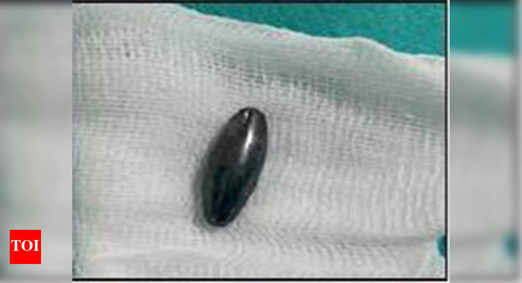 TOY MAGNET: Child swallows magnet, Mangaluru doctors use another to ...