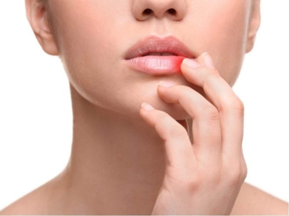 Here's how you can fix these embarrassing skin situations :::Misskyra