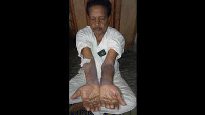62-year-old man says policemen tortured him | Ahmedabad News - Times of ...
