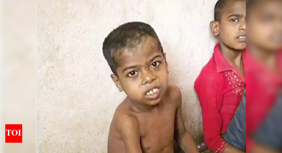 Poor health infrastructure bane of Panna children | India News - Times ...