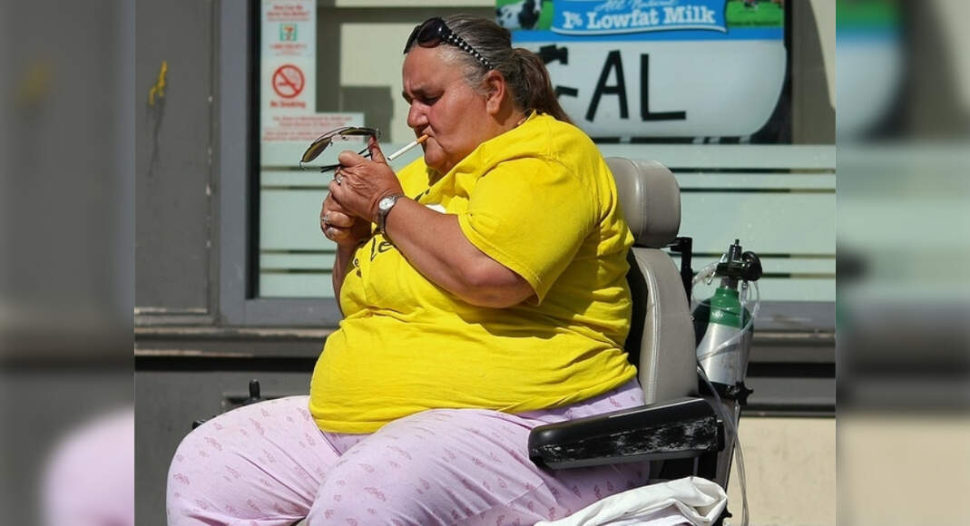 Study states that obesity can take over smoking in 25 years as a ...