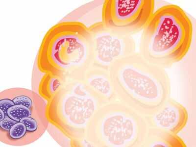 Rubella in pregnant women can adversely affect fetus: Experts | Nagpur ...