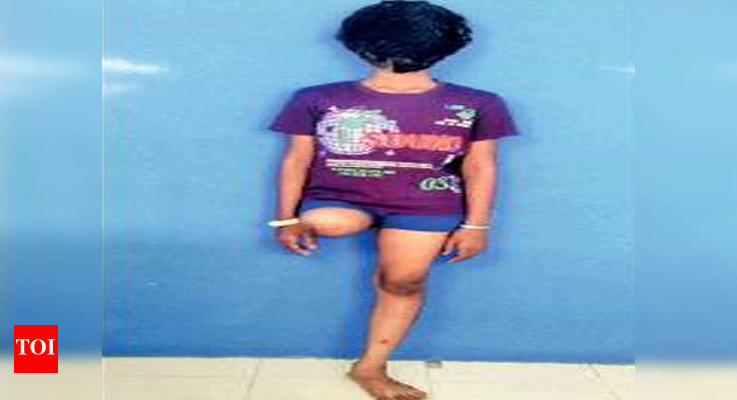 HC raises compensation for girl who lost leg to Rs52 lakh | Chennai ...