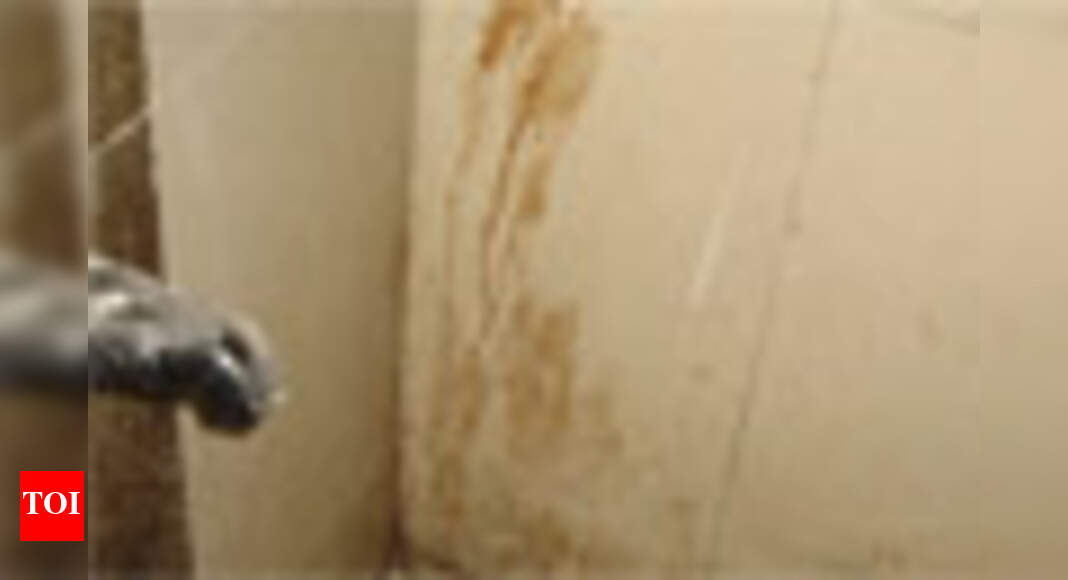 Warning: Stains are hazardous to nation's image | undefined News ...