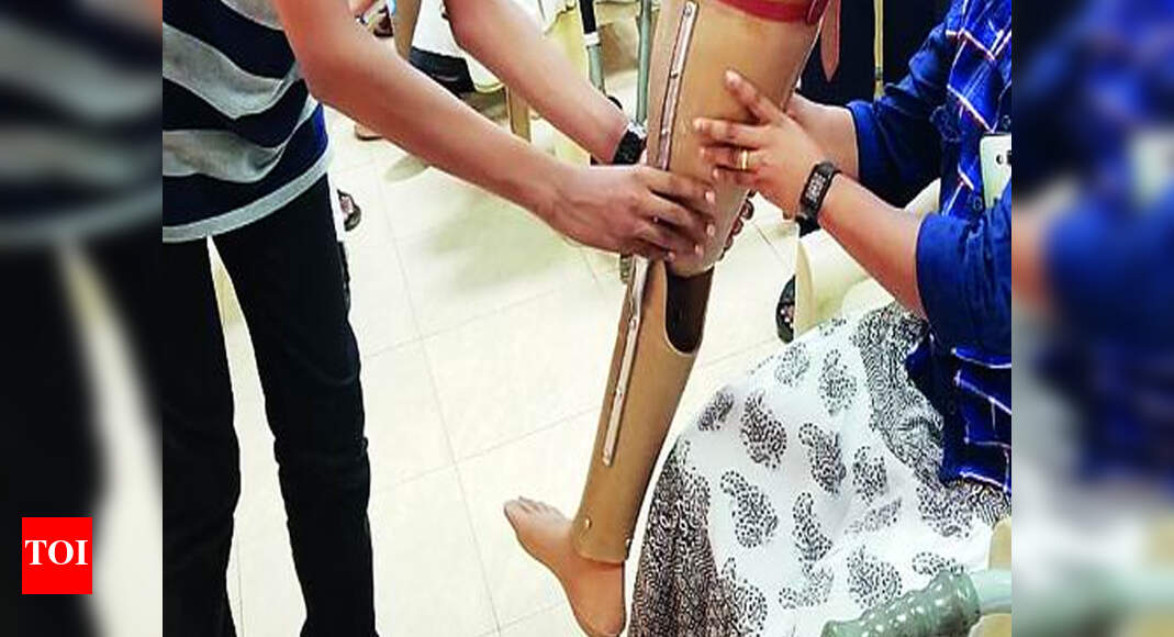 Pune: About 147 needy patients get Jaipur foot | Pune News - Times of India