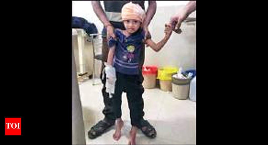 Mumbai: 6-year-old impaled by rod that pierced brain survives | Mumbai ...