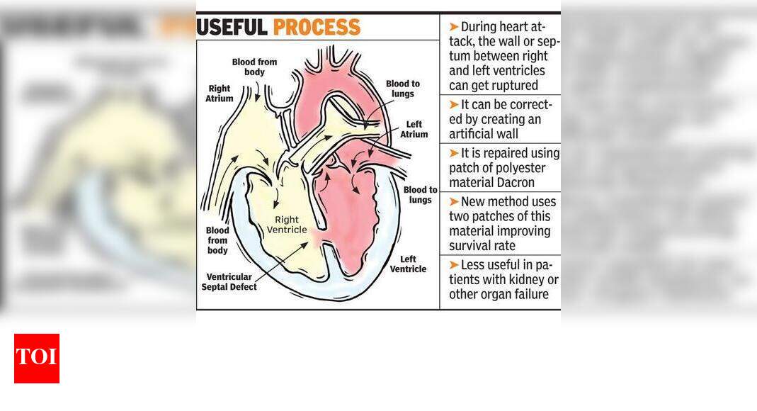 New technique ups survival rate of heart attack patients | Nagpur News ...