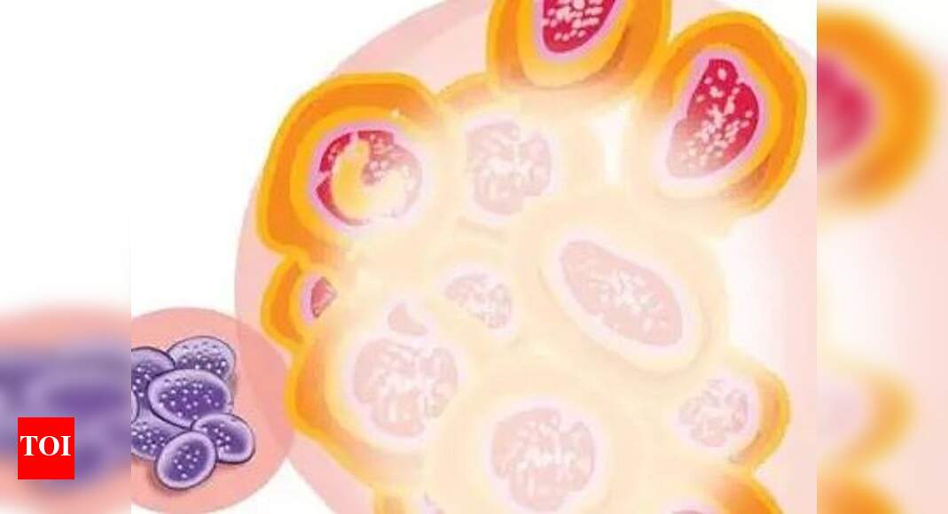 AHD deploys field-level teams in 3 districts, sets up monitoring cell ...