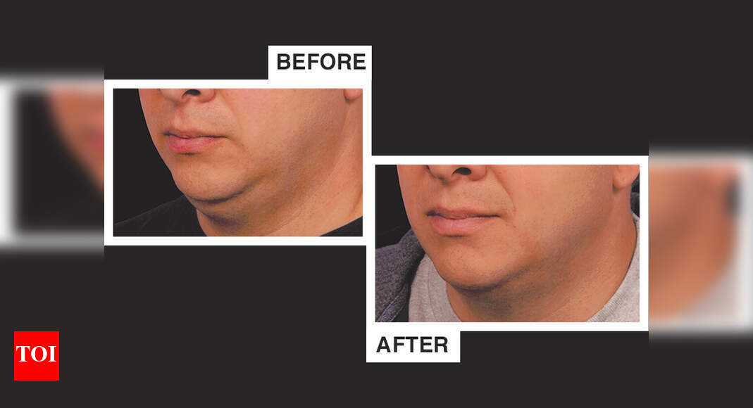 Everything you need to know about Coolsculpting & other non-surgical ...