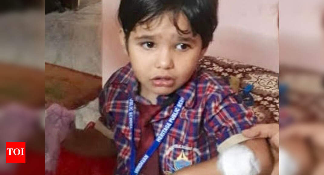 Up Monkey Menace: UP: Three-year-old attacked by monkey in Vrindavan ...