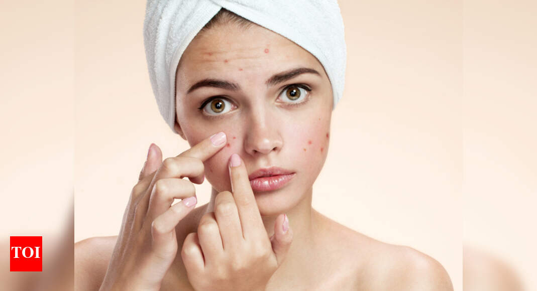 Teen Acne (Pimples): How to Get Rid of Teen Acne | Acne Treatment for ...