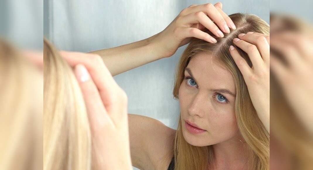 Best Ways To Get Rid Of Smelly Scalp