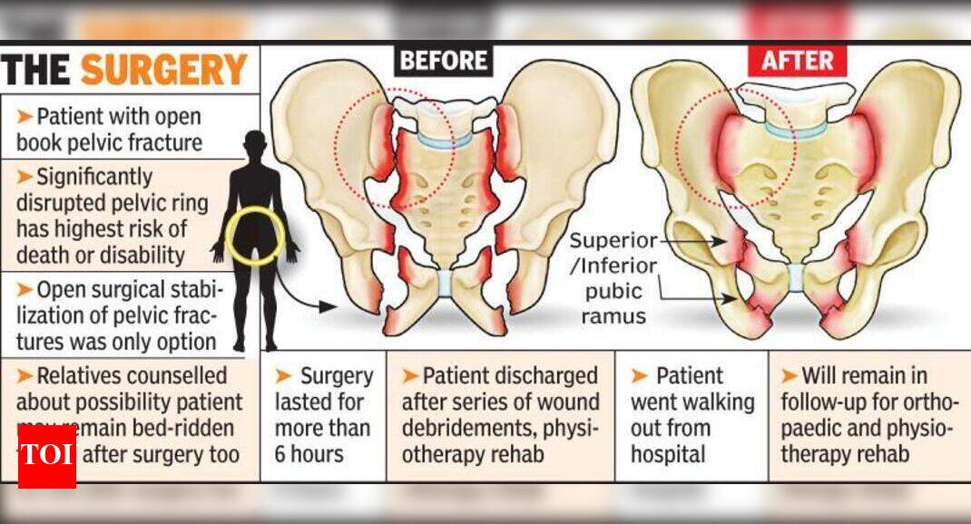 Docs Restructure Crushed Pelvis Of 52 Yr Old Nagpur News Times Of India