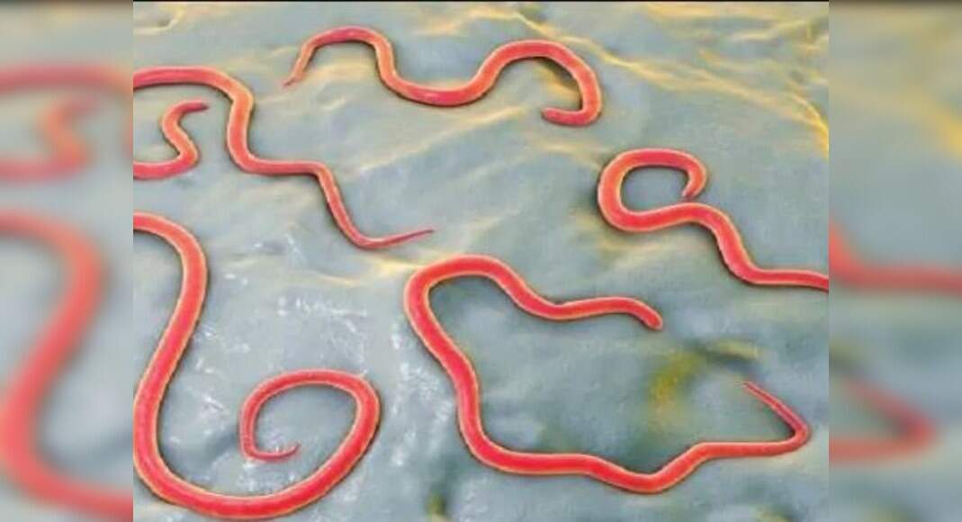 Water treatments highly effective in cutting down roundworm infections ...