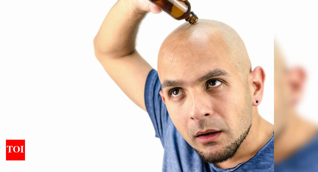 Get Rid Of Permanent Hair Loss With These Advance Treatments Times Of get-rid-of-permanent-hair-loss-with-these-advance-treatments-times-of