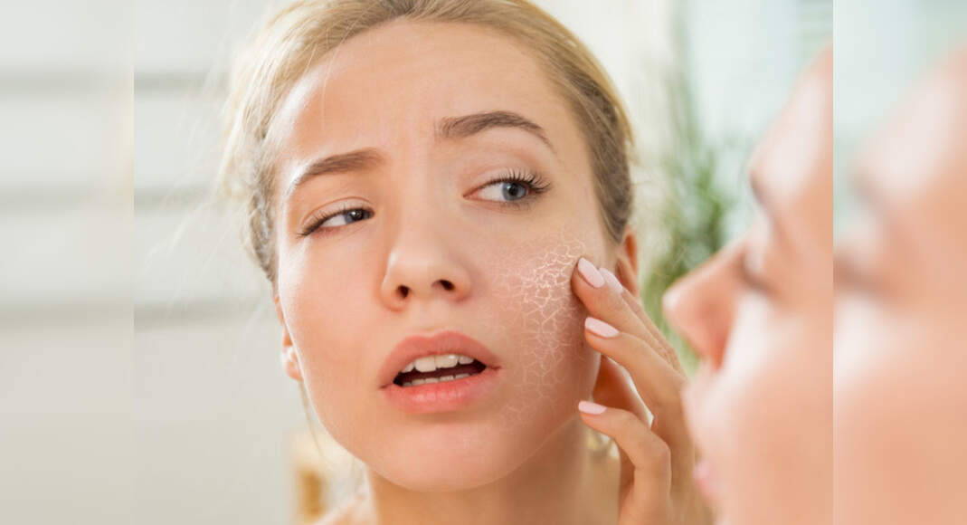 If you have dry skin, you must avoid these things at all costs ...