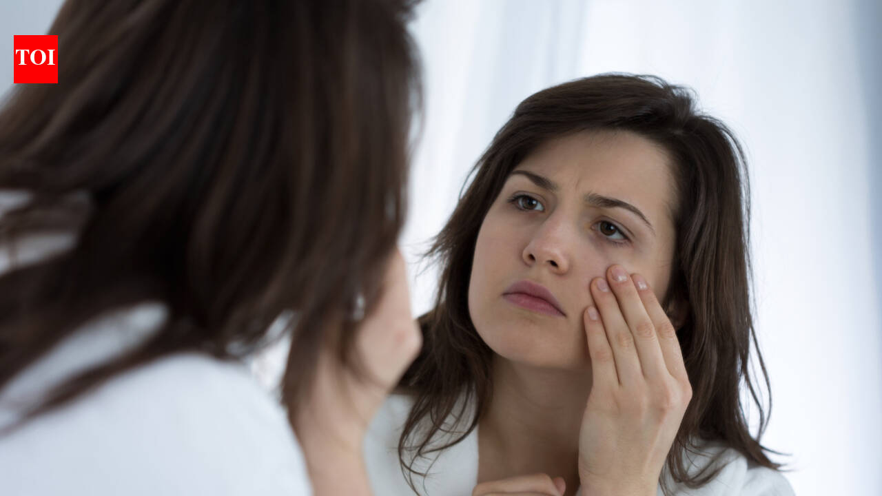 5 reasons your eyes look tired even after getting a good night's sleep
