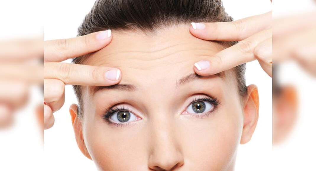 You can put these home remedies to use to get rid of furrow lines ...