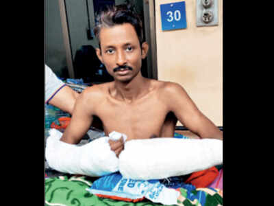 West Bengal: Surgery gives back man hands, a second shot at life ...