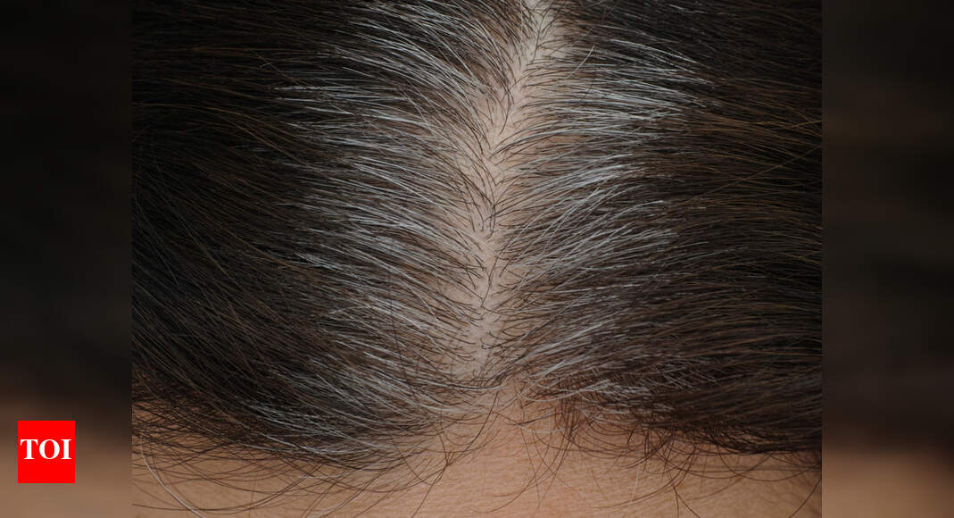 Scientists reveal the REAL reason why your hair is turning grey - Times ...