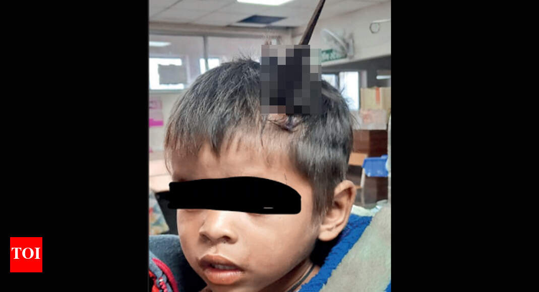 Doctors remove 4-inch arrow from child's head in Madhya Pradesh ...