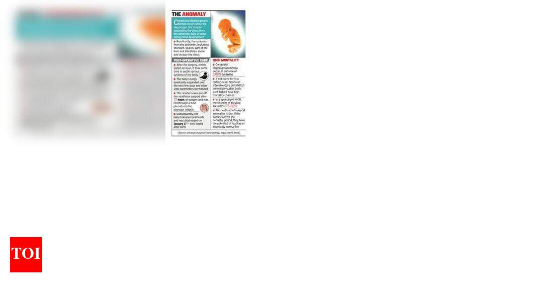 Hour-long surgery cures baby of rare birth defect | Pune News - Times ...