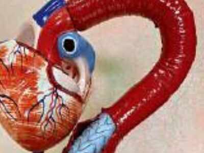 Kerala: Sree Chitra develops low cost stent graft | Thiruvananthapuram ...