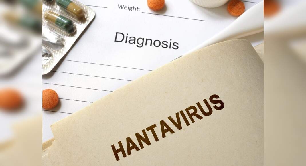 Hantavirus symptoms and how it spreads - Misskyra.com