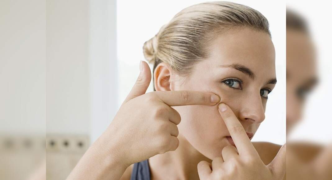 Dermatillomania or skin picking disorder - What is it and how to treat ...