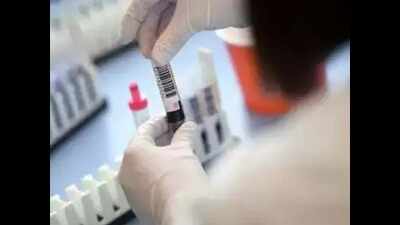 Chandigarh: PGI starts diagnostic test for Covid-19 in emergency cases ...