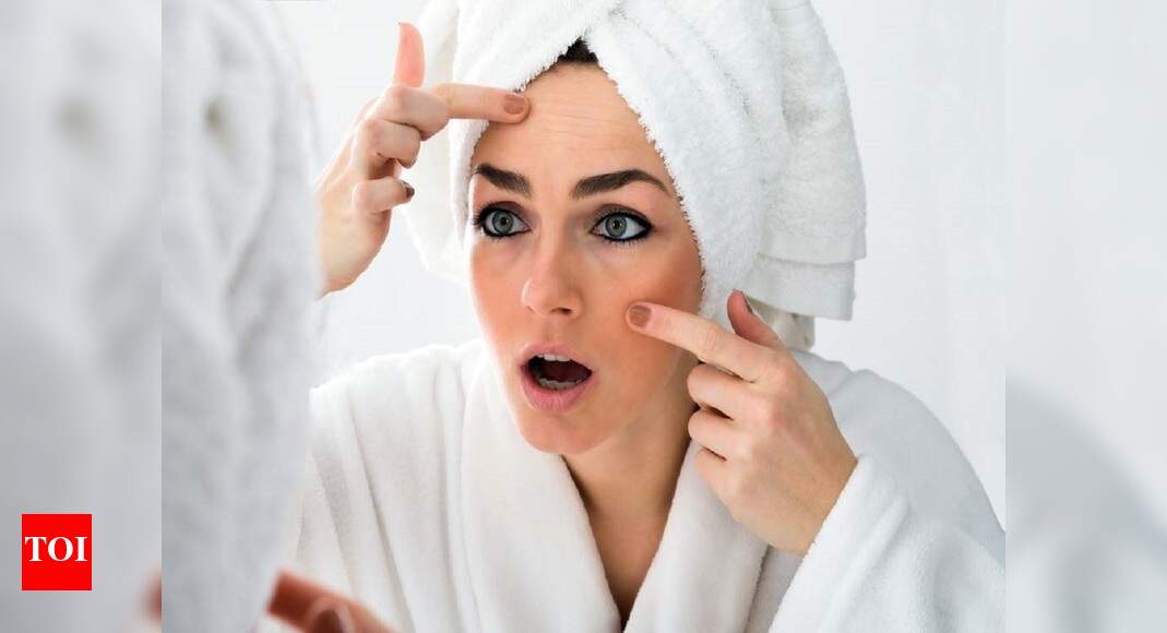 Face Pack for acne and pimple prone skin - Times of India