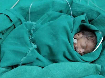 Chhattisgarh's 1st 'miracle baby' survives beating odds | Raipur News ...