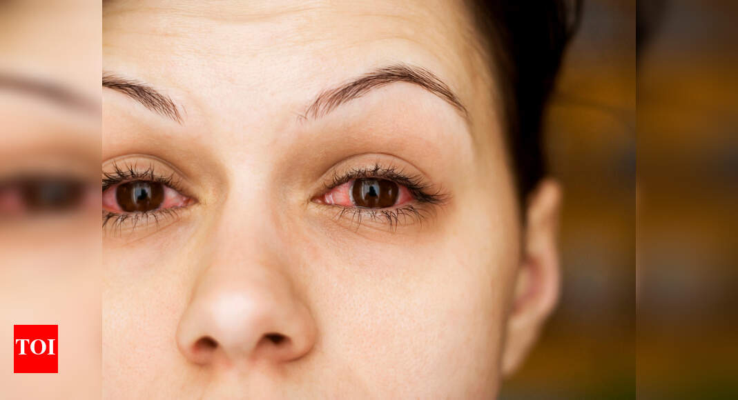 3 types of eye infections and tips to prevent them during monsoon ...