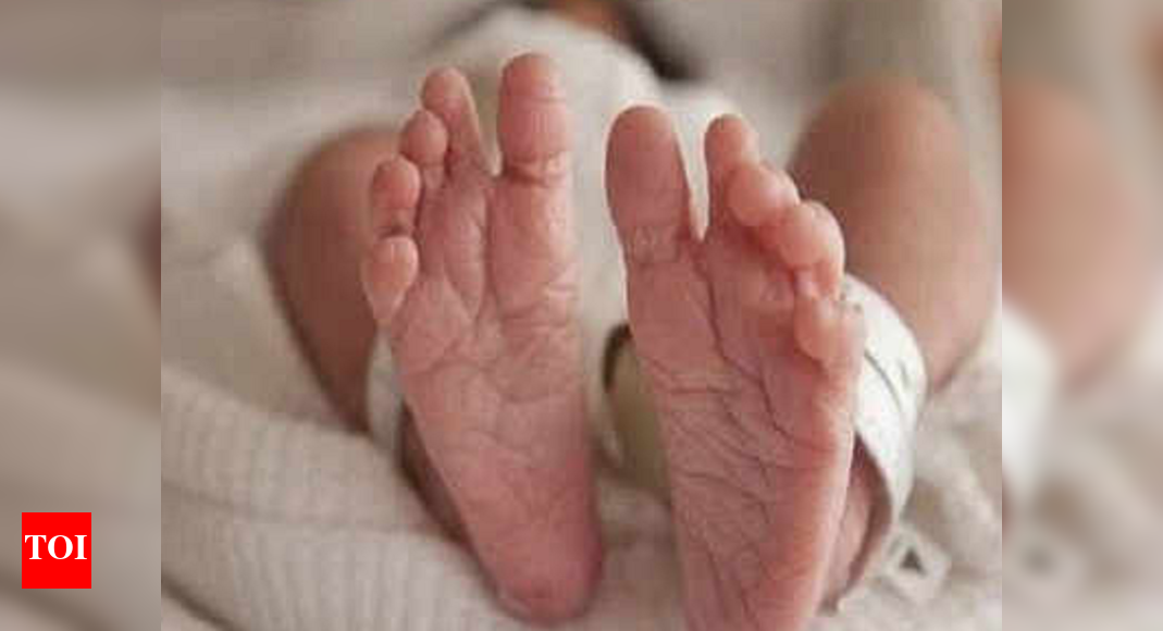 Baby born with rare condition treated in Chennai | Chennai News - Times ...