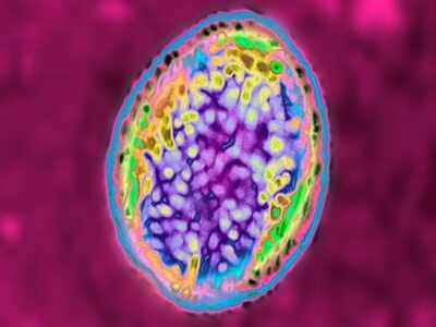 Bacterial outbreak infects thousands in China amid coronavirus - Times ...