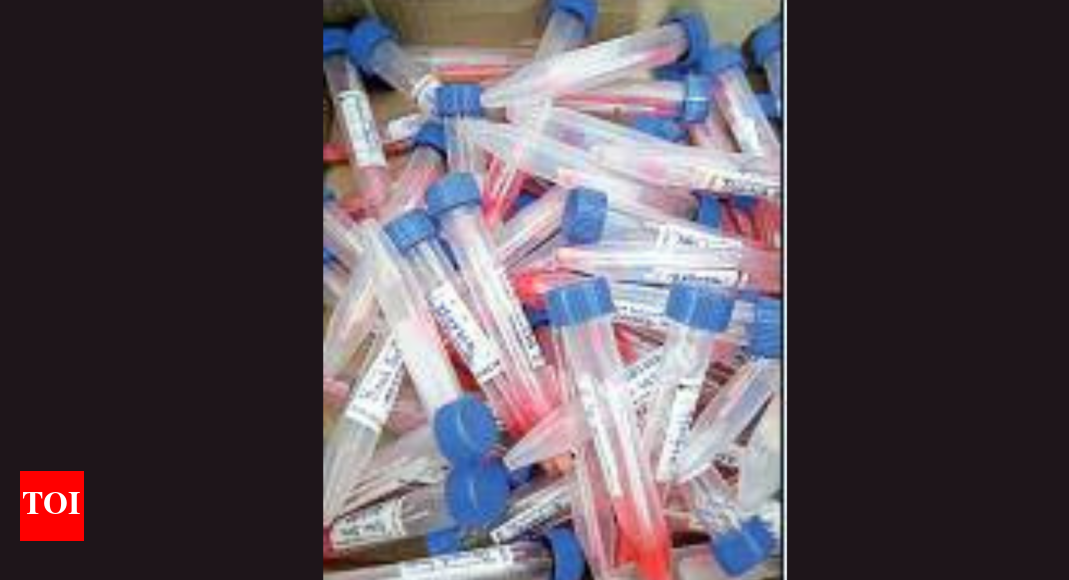 Bangalore Coronavirus Update: Getting negative test result a challenge ...