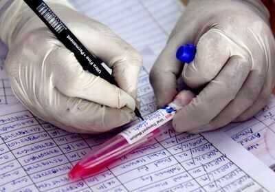 RT-PCR test to cost Rs 700 now | Gurgaon News - Times of India