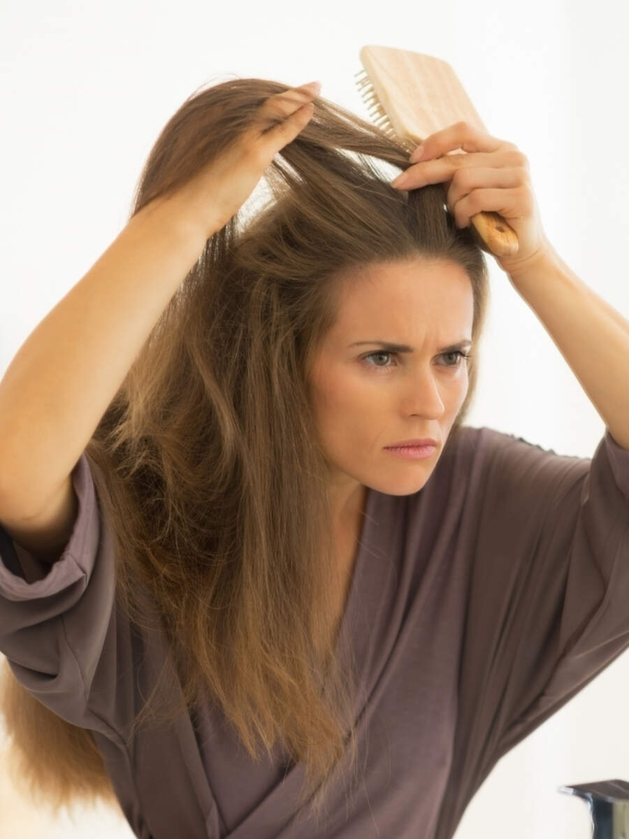 Remedies to get rid of dandruff naturally | Times of India