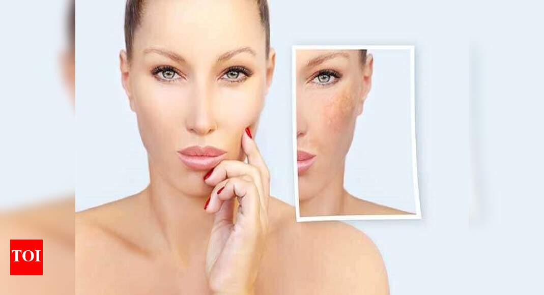 Anti-pigmentation face wash: Get flawless skin in minutes - Times of India