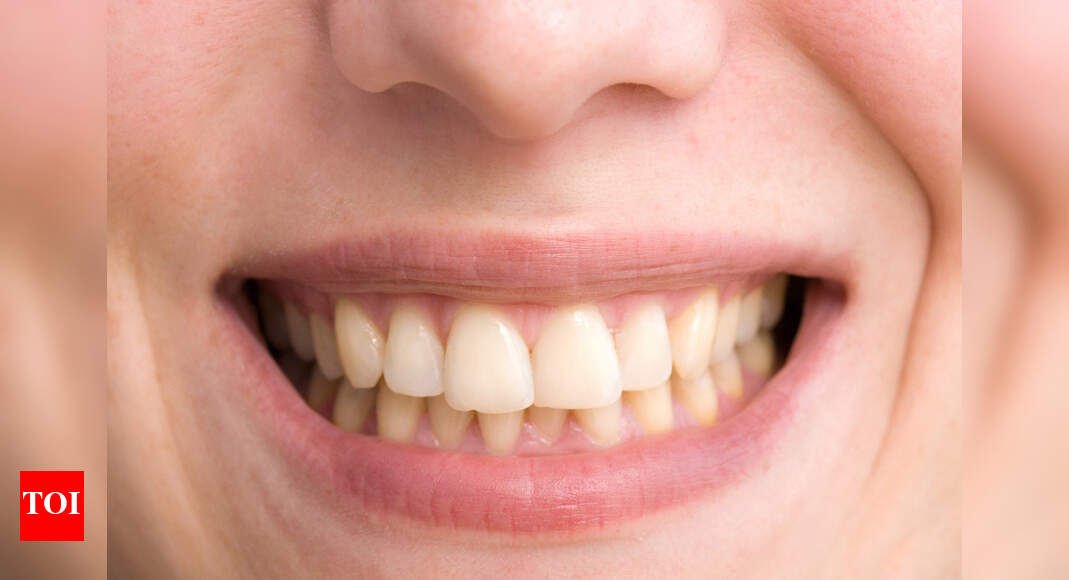 How To Get Rid Of Yellow Teeth Naturally: 3 Grandma approved home ...