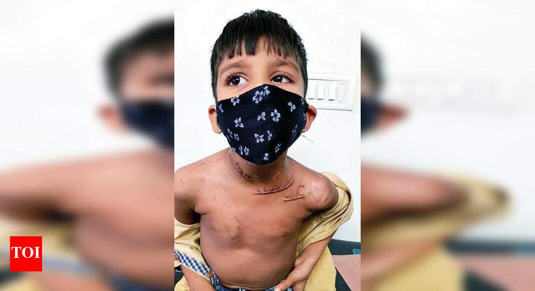 Toy stick stuck in 6-yr-old’s neck removed after surgery | Vadodara ...