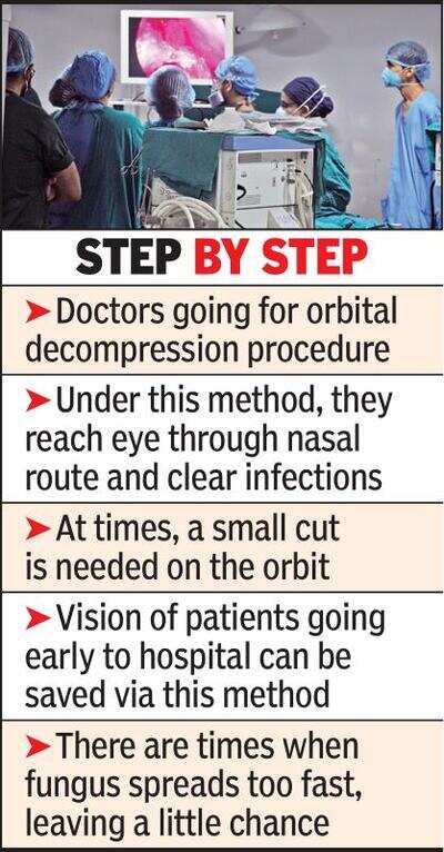 Docs see ray of hope to salvage vision of mucor patients | Nagpur News ...
