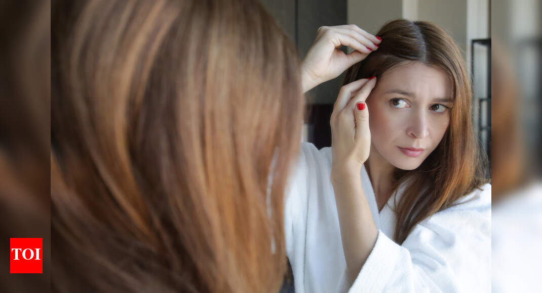 Stress does change the colour of your hair, here's proof! - Times of India