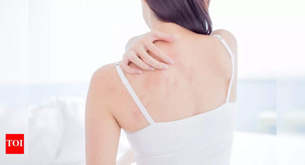 Monsoon Skin Allergies: Lookout for these 5 skin allergies during the ...