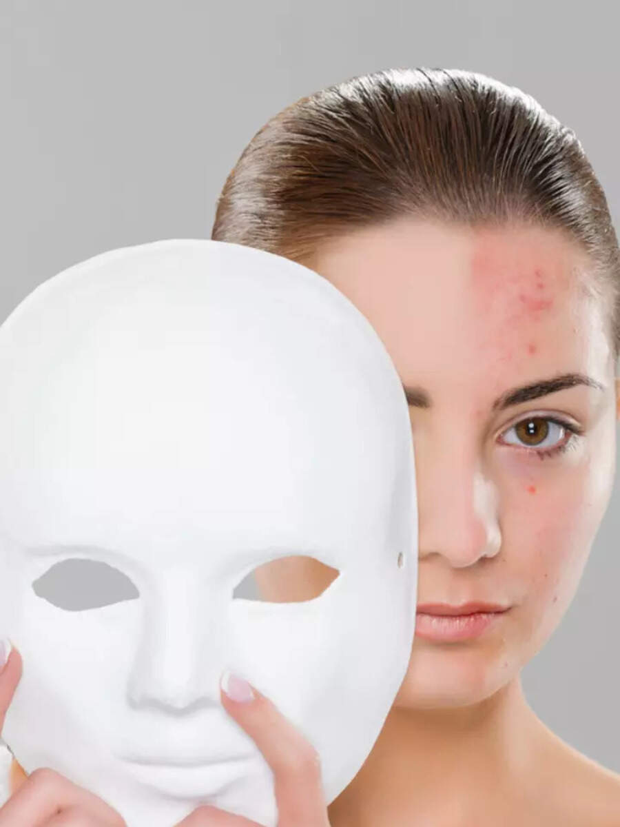 How to perfectly hide a pimple | Times of India