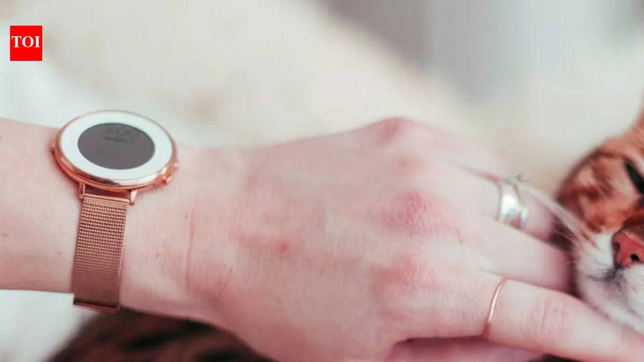 Rose gold smartwatches for women that combine tech and style | - The ...
